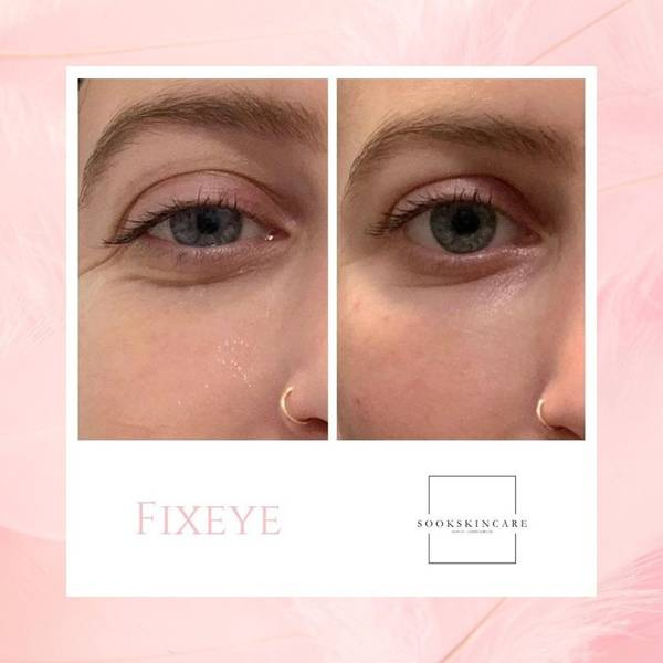 Masażer LED do pielęgnacji okolic oczu (FIXEYE) SookSkinCare | sklep ...